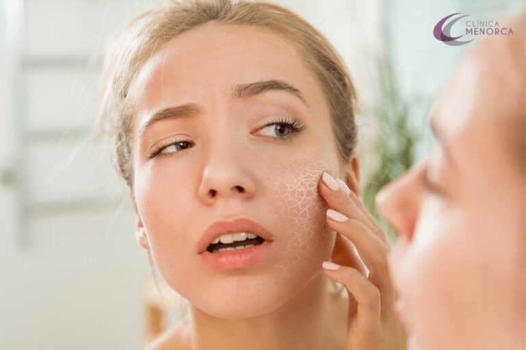 Piel descamada: causas y cómo tratar el problema